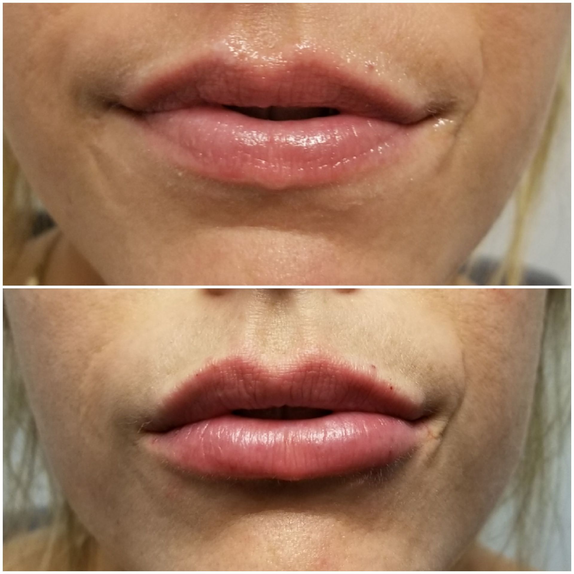 Natural Injections Med Spa by Laura