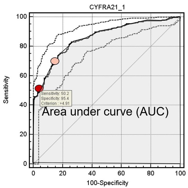 ROC-Kurven: statistischer Berechnung, Interpretation und Grenzen