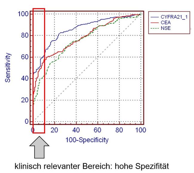 ROC-Kurven: statistischer Berechnung, Interpretation und Grenzen