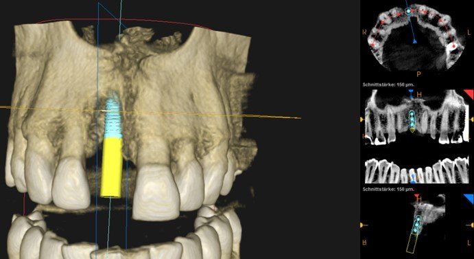 3D/DVT Röntgen bei Zahnarzt Doz. DDr. Heinz-Dieter Müller, PhD in Linz