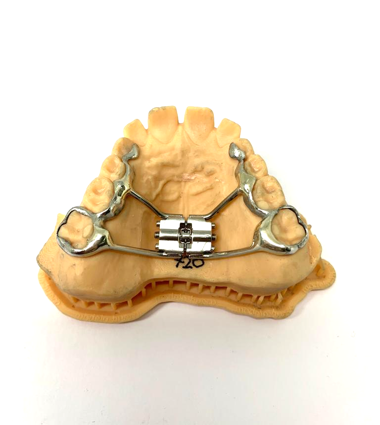 Aparatología de Ortodoncia. Disyunción, fija, removible y funcional.