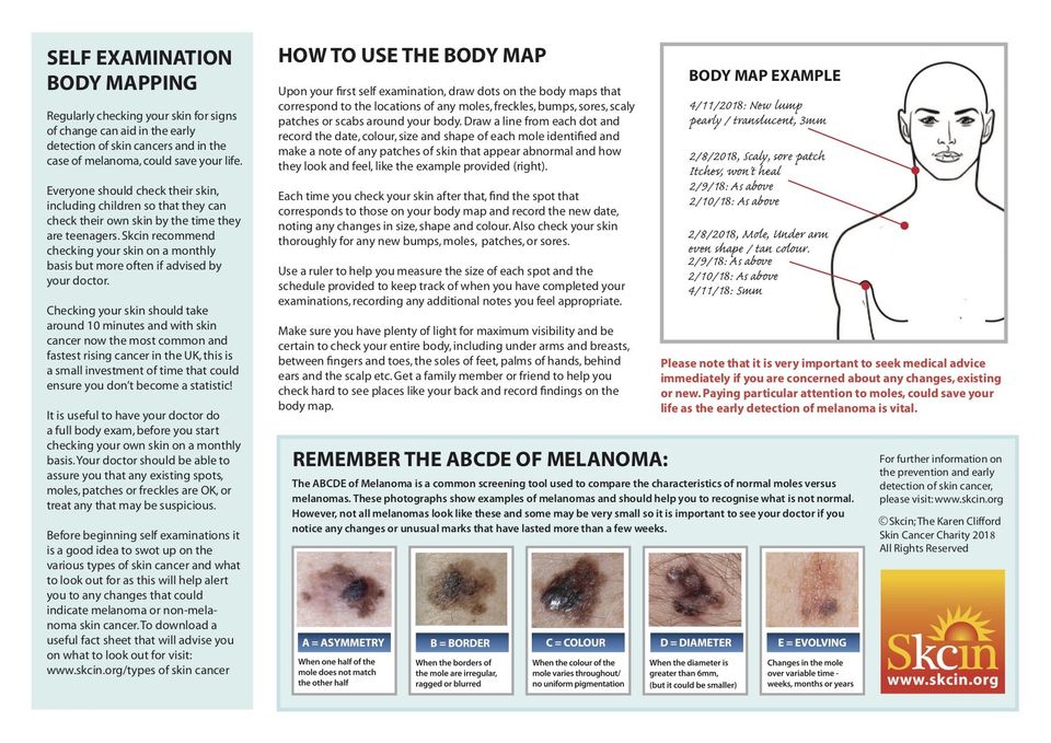 Skin Cancer Body Mapping at Kate Gask blog