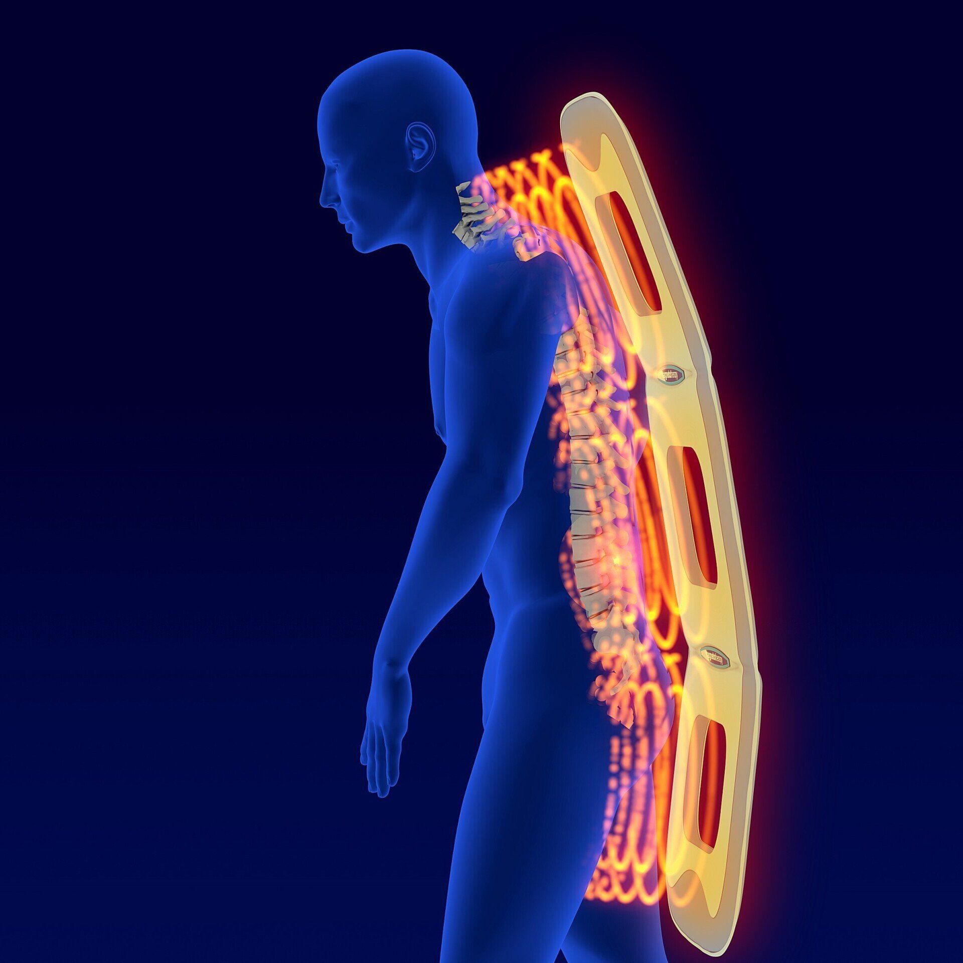 Magnetoterapia Radisson - ¿Qué es la Magnetoterapia?
