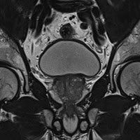 Radiologie Praxis Leipzig für MRT Untersuchungen