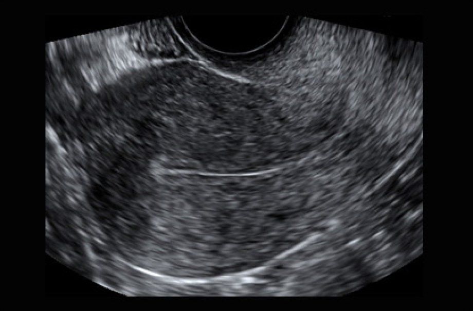 ultrasoundpartners
