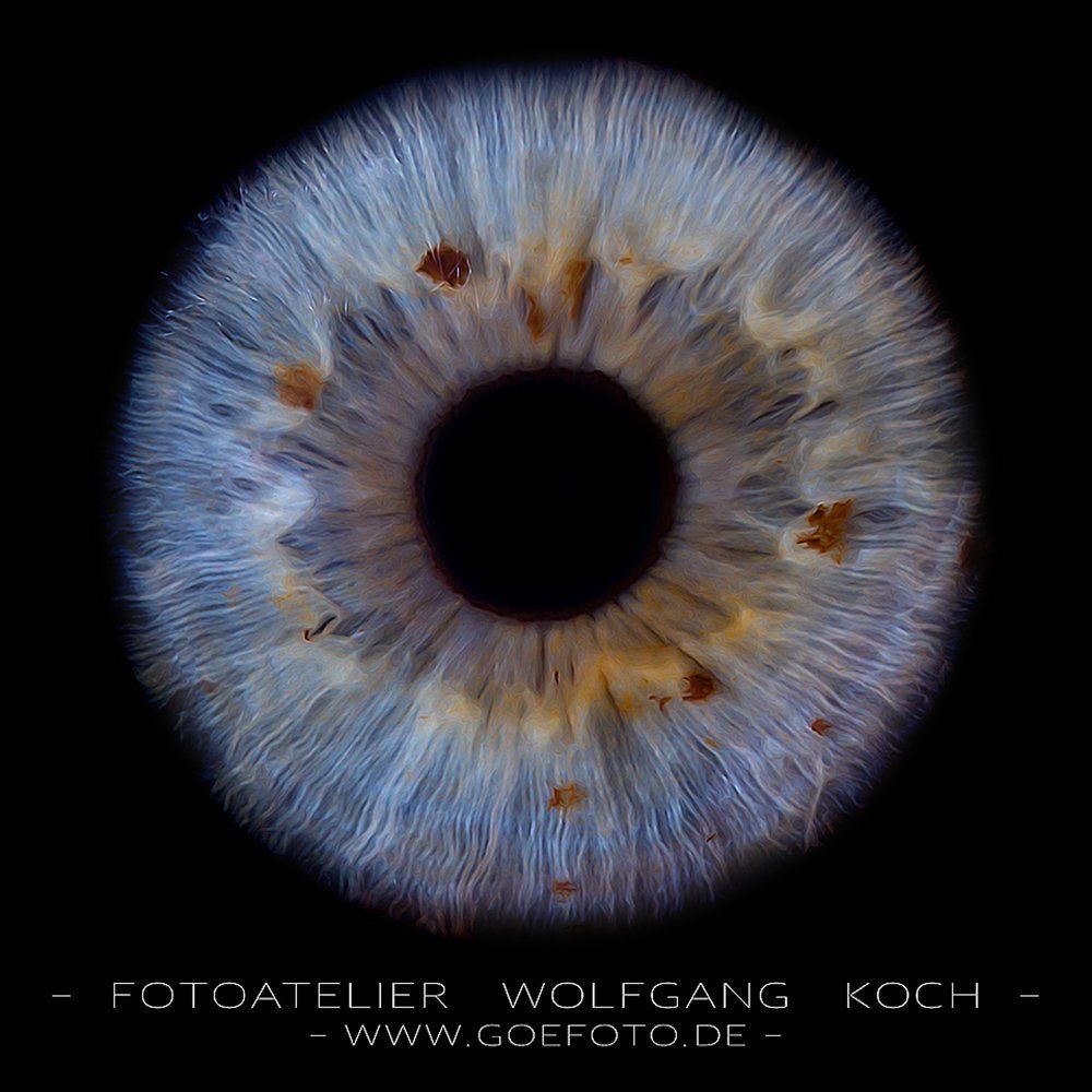 Irisfotografie, Irisfoto Göttingen