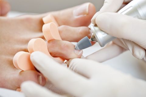 The Forum Foot Clinic -Toenail reconstruction - Foot care